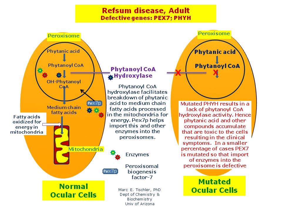 Refsum Disease, Adult | Hereditary Ocular Diseases